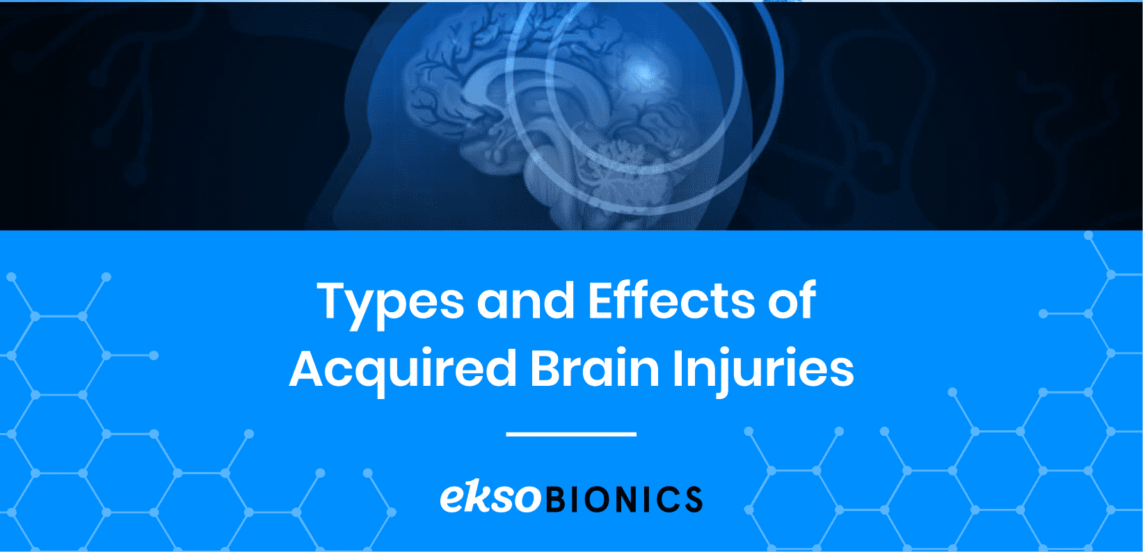 How Exoskeletons Are Beneficial for Acquired Brain Injuries