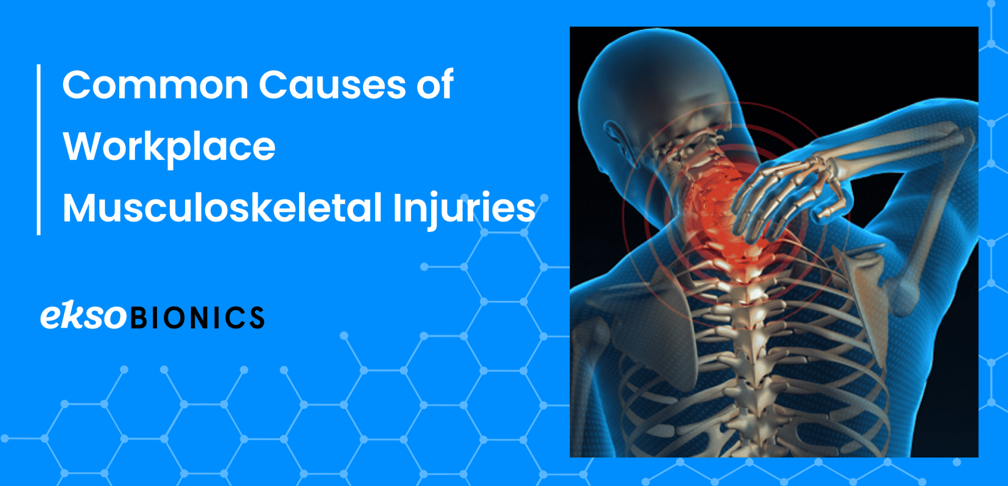 How Do Exoskeletons Prevent Work Injuries?