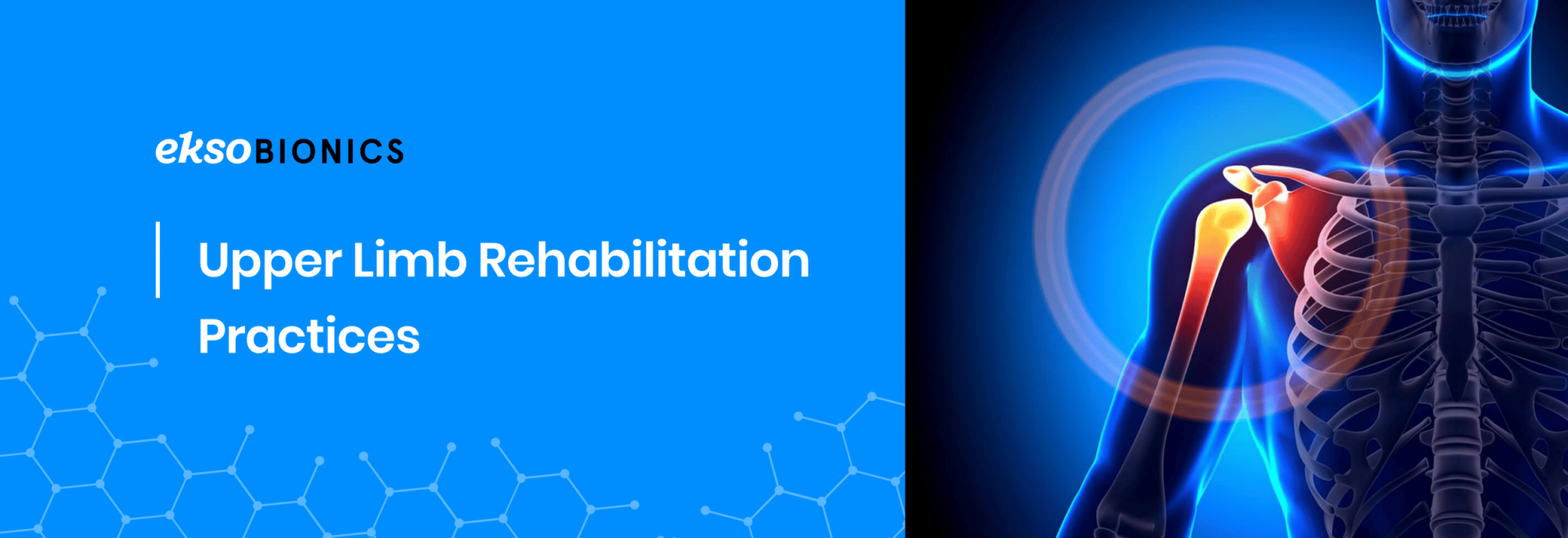 Physical Therapy Treatment Methods For Stroke Rehabilitation